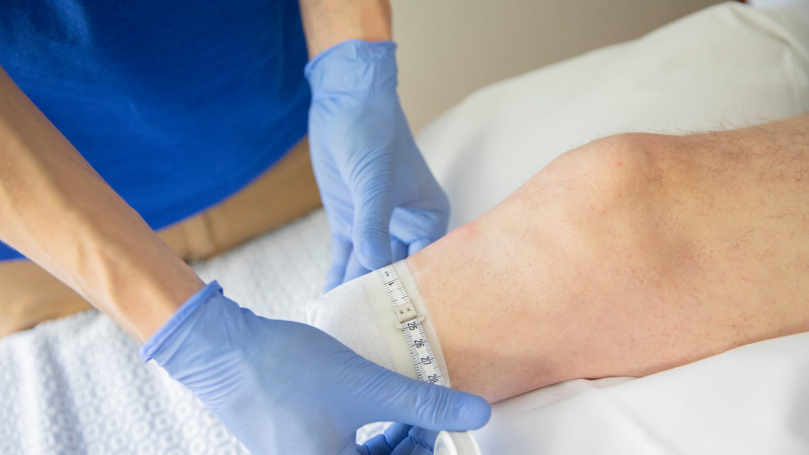 About Leg Amputation. Ossur.com